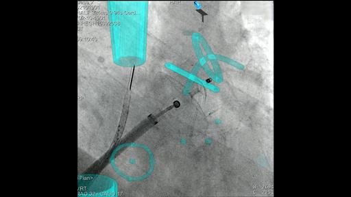 Cardiology Solutions