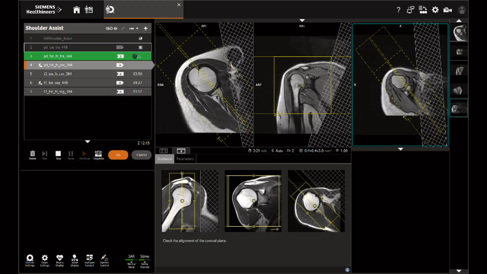 Musculoskeletal Imaging - Siemens Healthineers USA