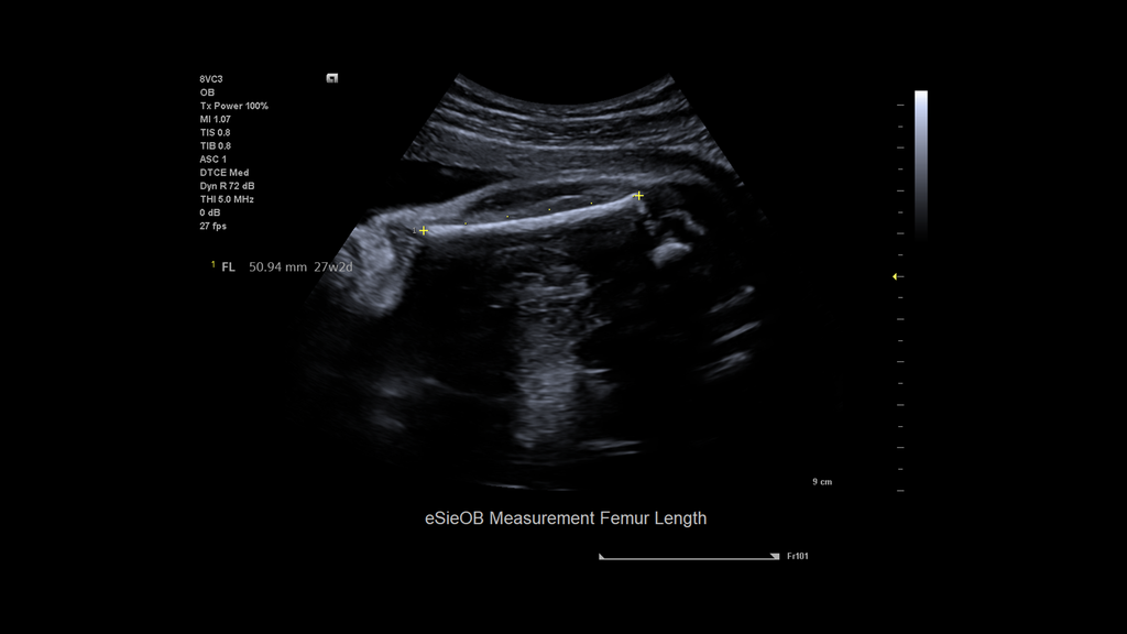ACUSON Juniper is a High-Performance Shared Service Ultrasound System ...