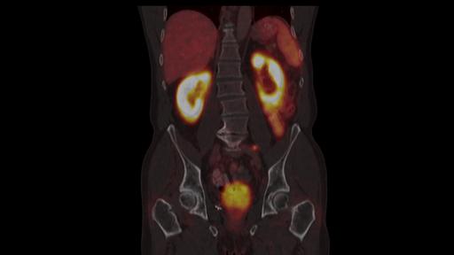 Molecular Imaging - Siemens Healthineers