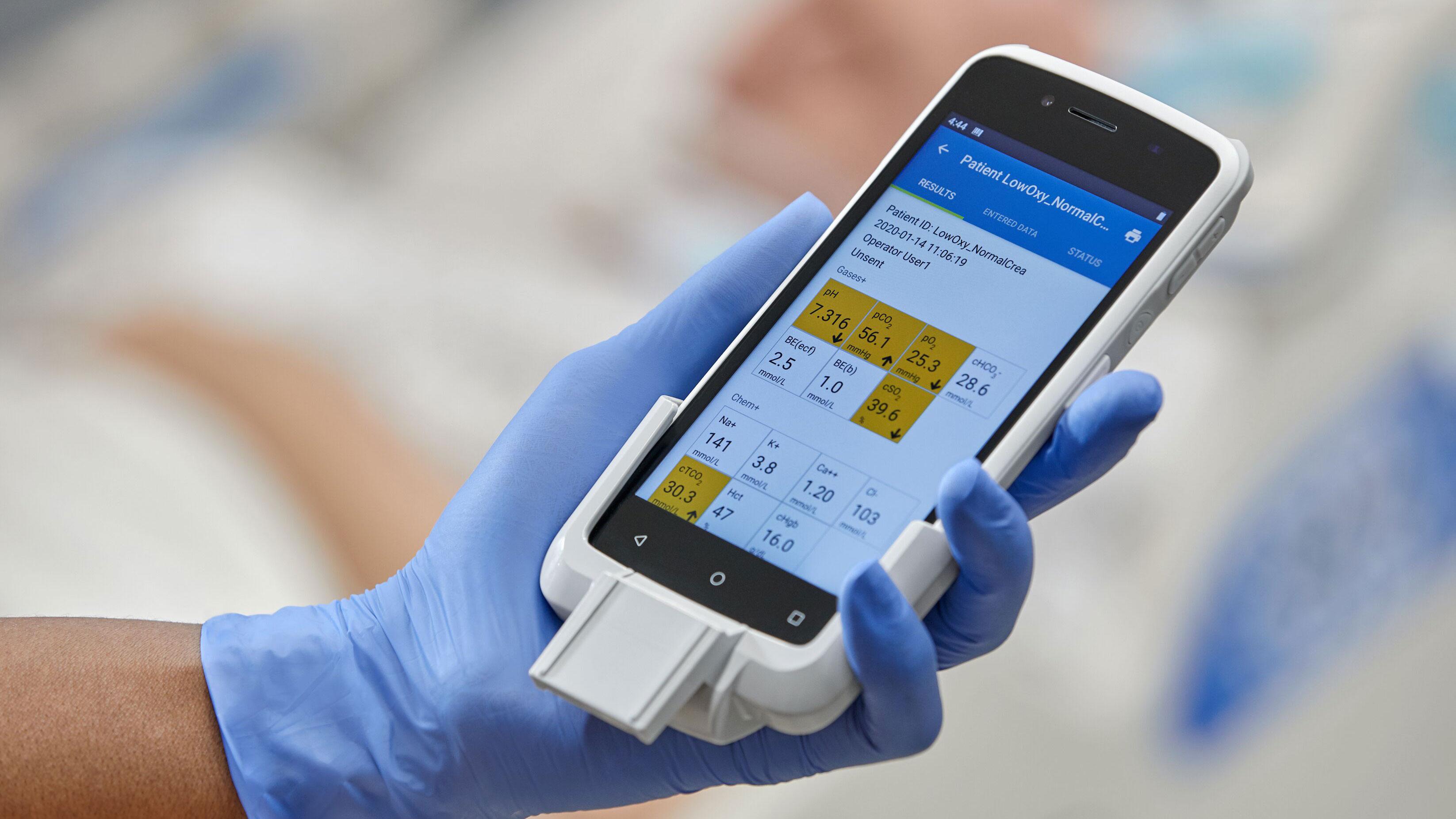 Value of implementing patient-side testing at a large community ...