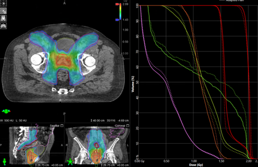 Changing the way we think about radiation delivery