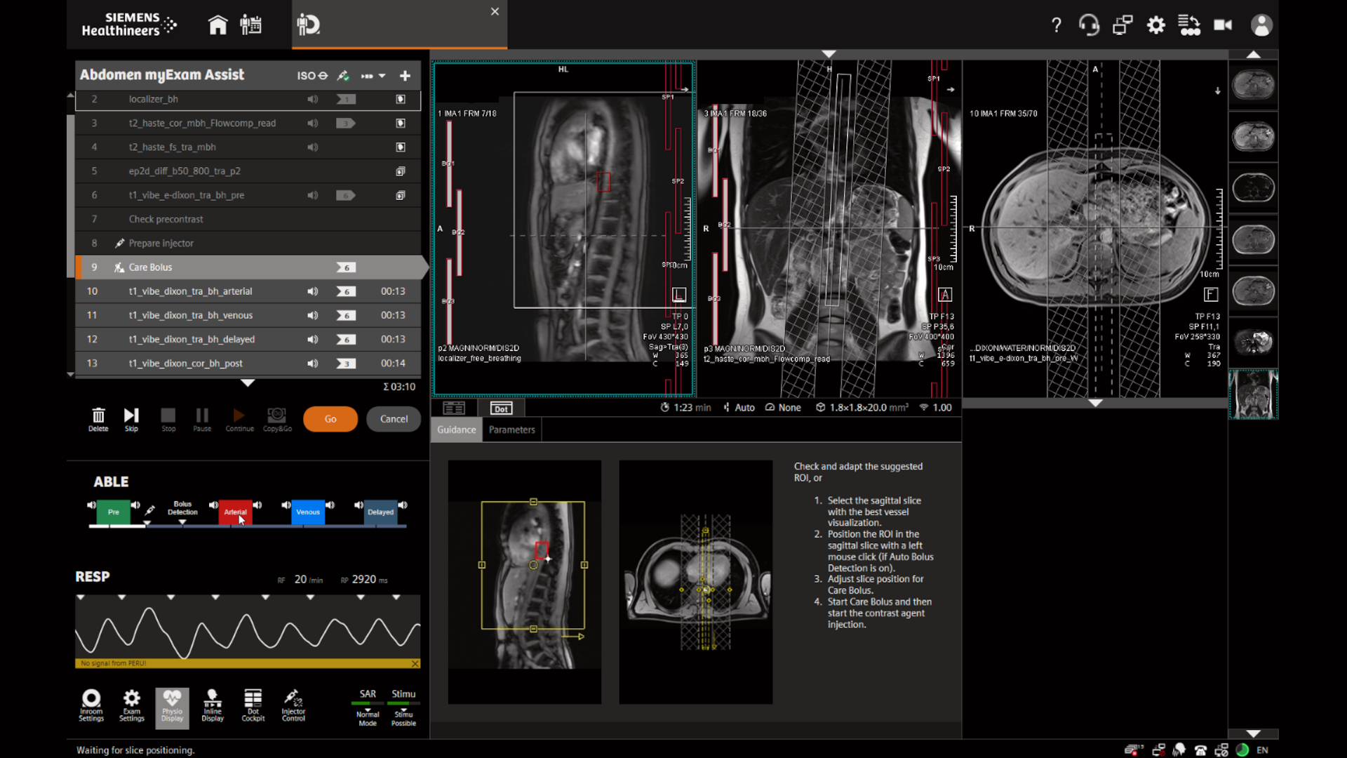 Liver Cancer Management - Siemens Healthineers