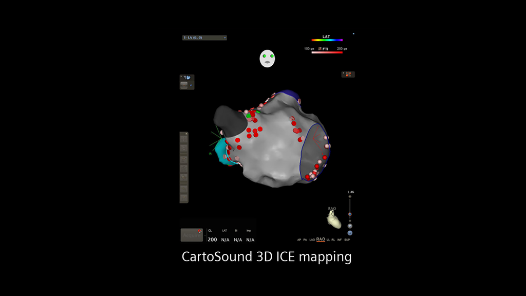 Cardiovascular Ultrasound | ACUSON SC2000 Ultrasound System - Siemens ...