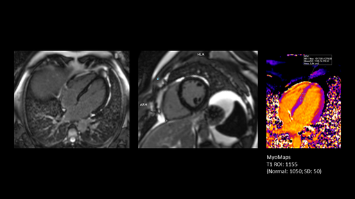 MR imaging in sports medicine