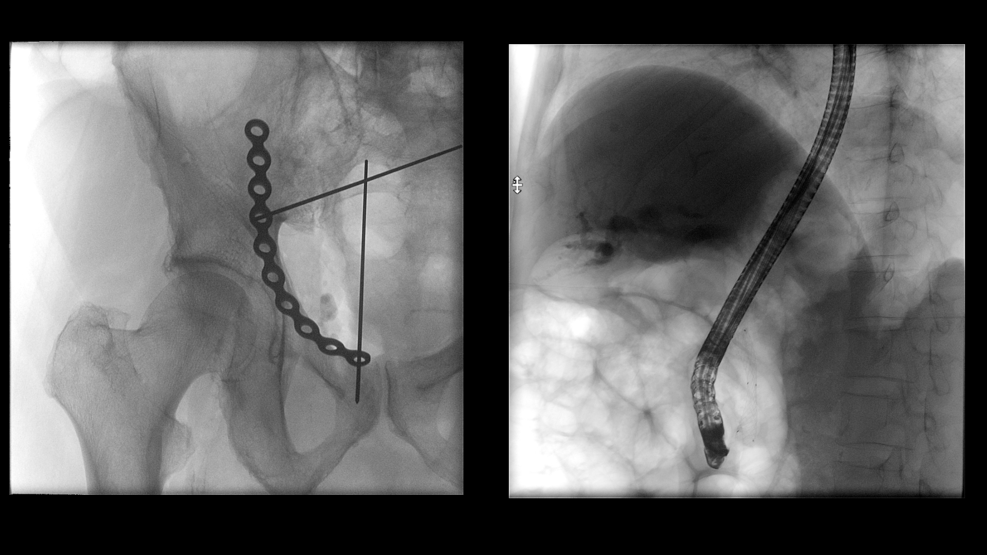 Cios Flow - Siemens Healthineers USA