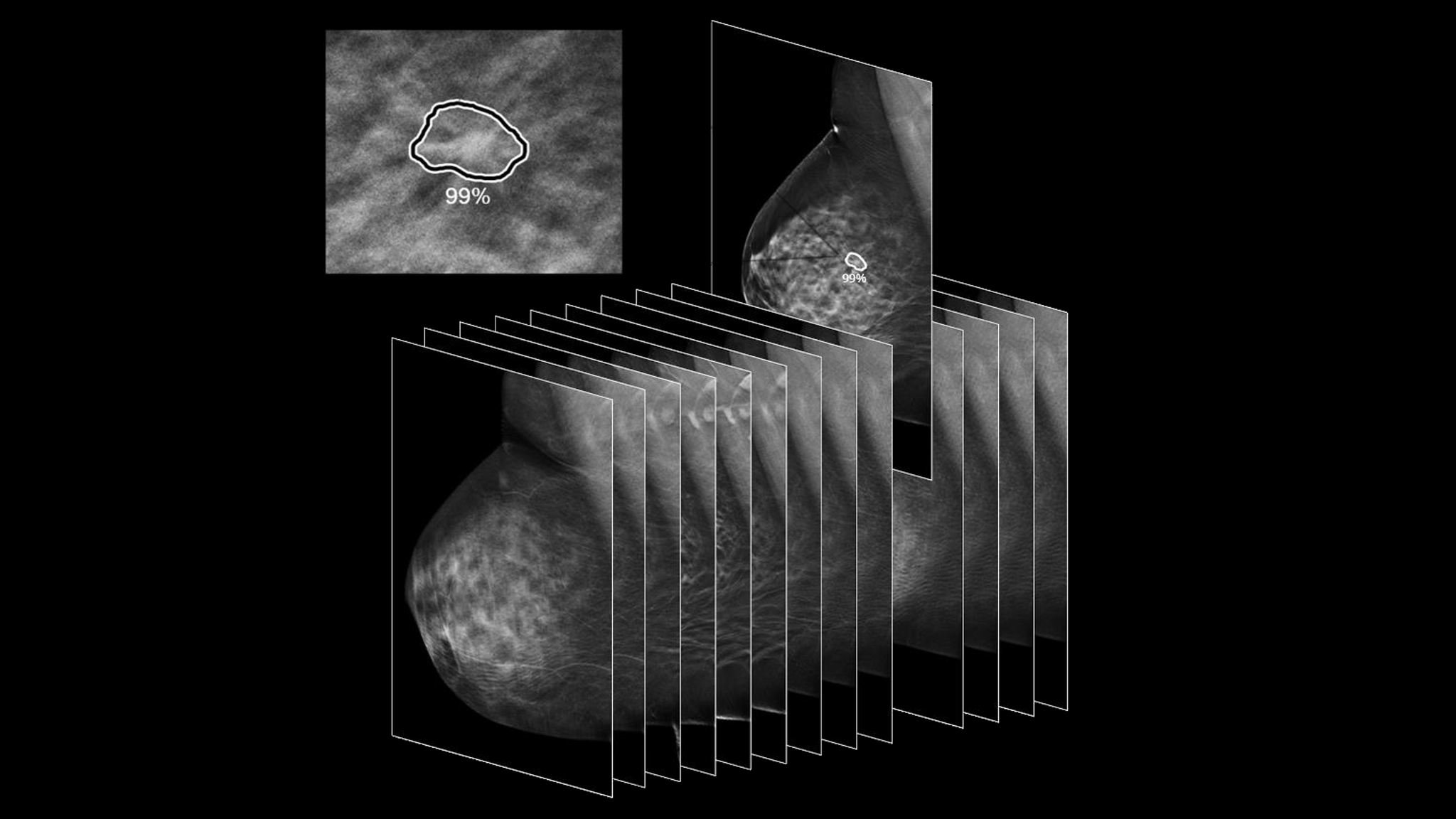 MAMMOMAT Revelation - Siemens Healthineers USA