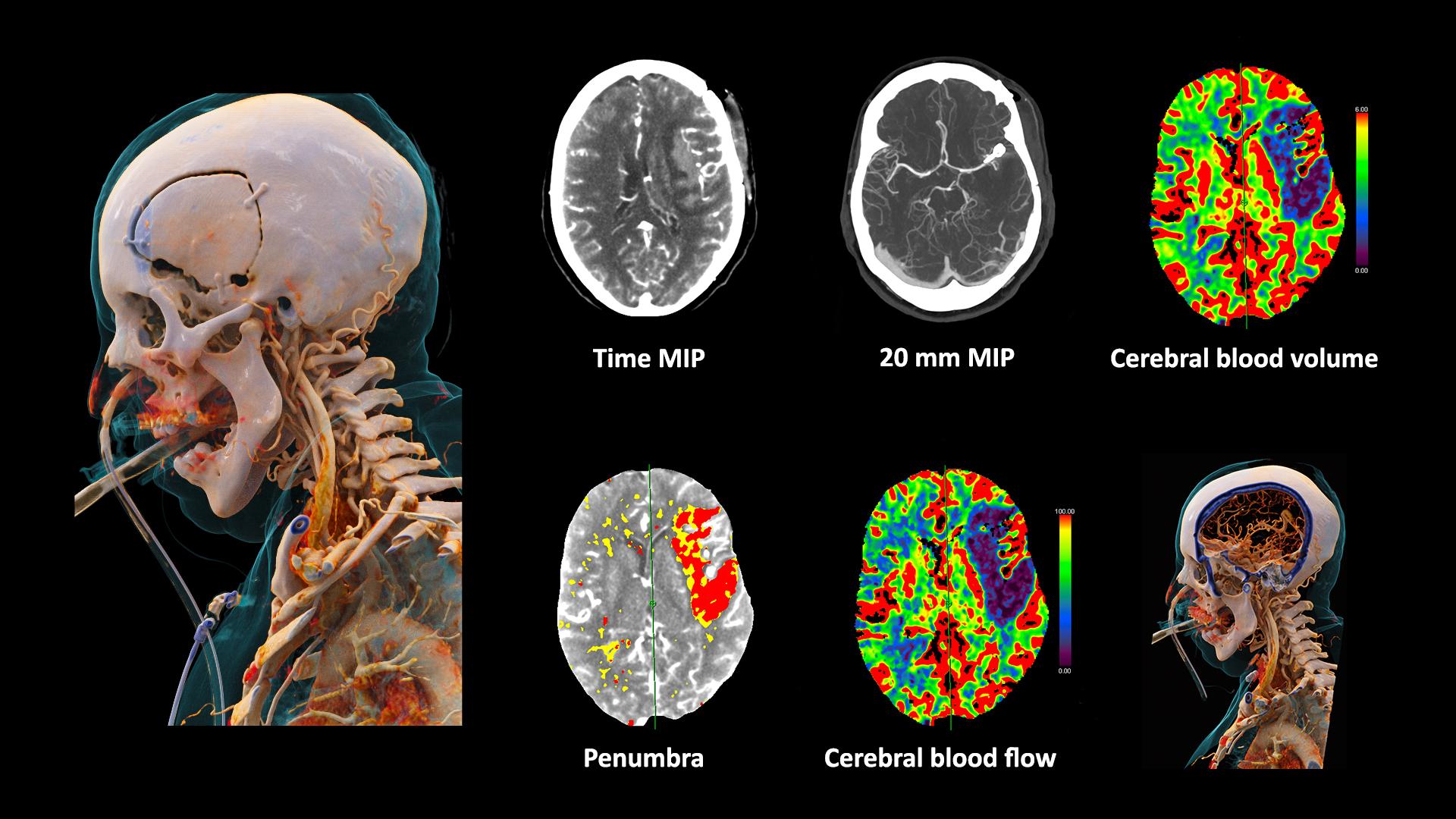SOMATOM Edge Plus - Siemens Healthineers USA