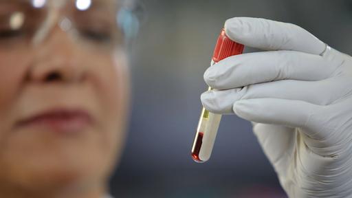 Order the ELF Test - Siemens Healthineers USA