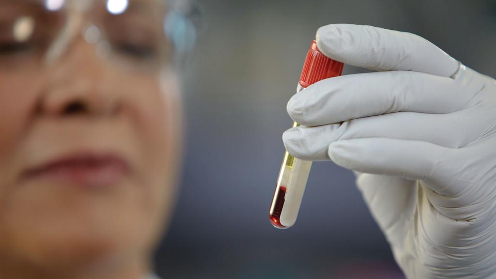 Get ELF in your Laboratory - Siemens Healthineers USA