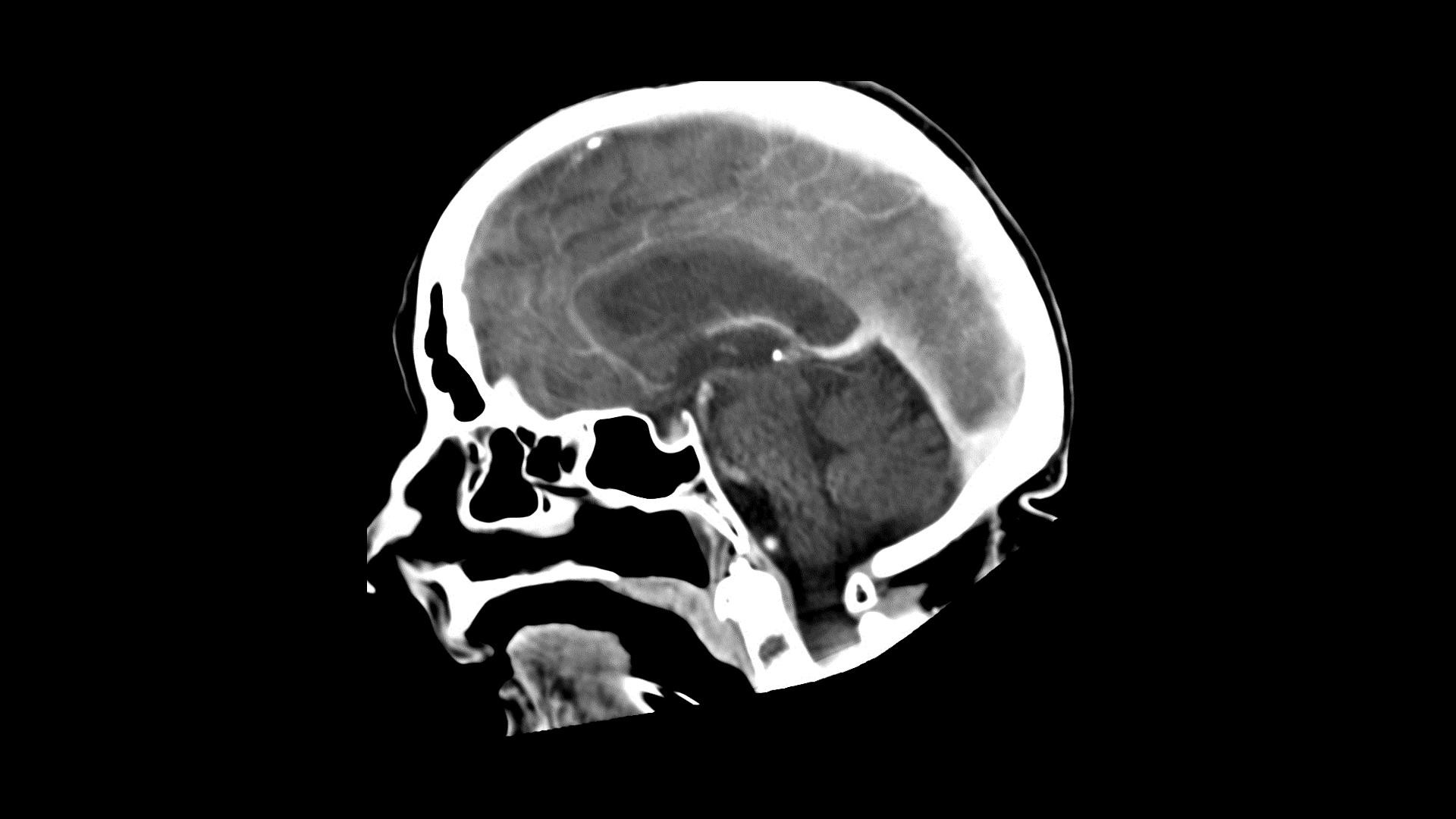 syngo DynaCT - Siemens Healthineers USA