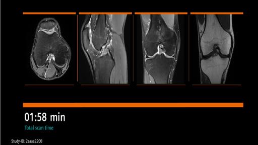 Deep Resolve - Siemens Healthineers