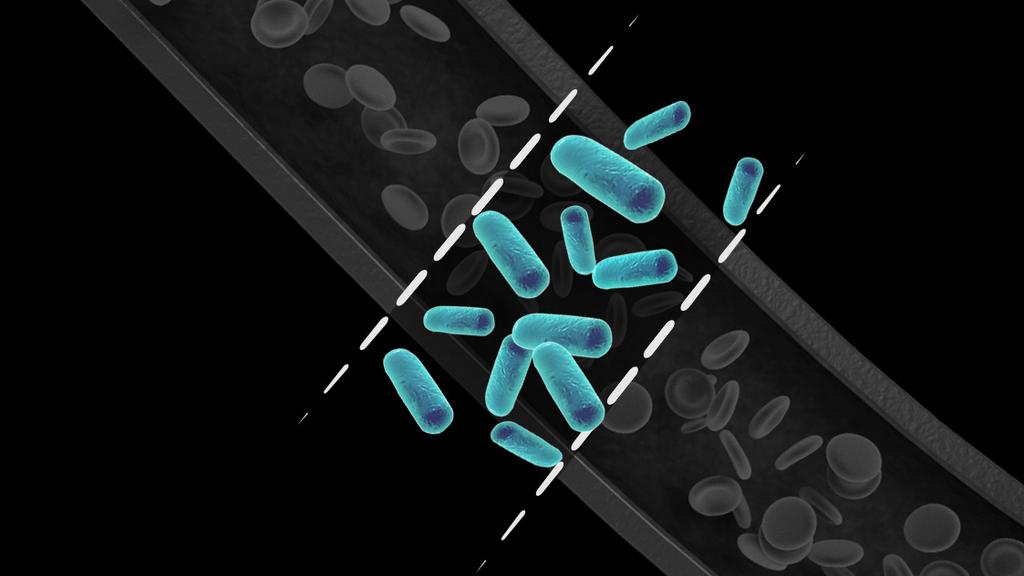B·R·A·H·M·S Procalcitonin (PCT) Assay - Siemens Healthineers