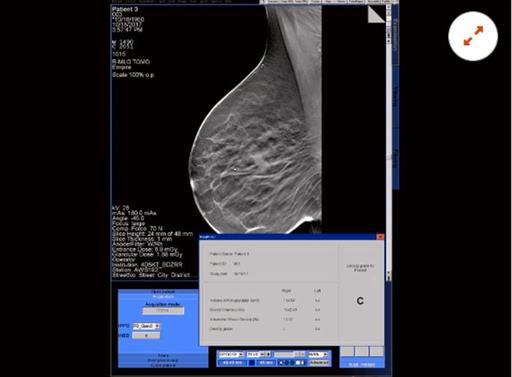 Breast AI – Embrace the power of more
