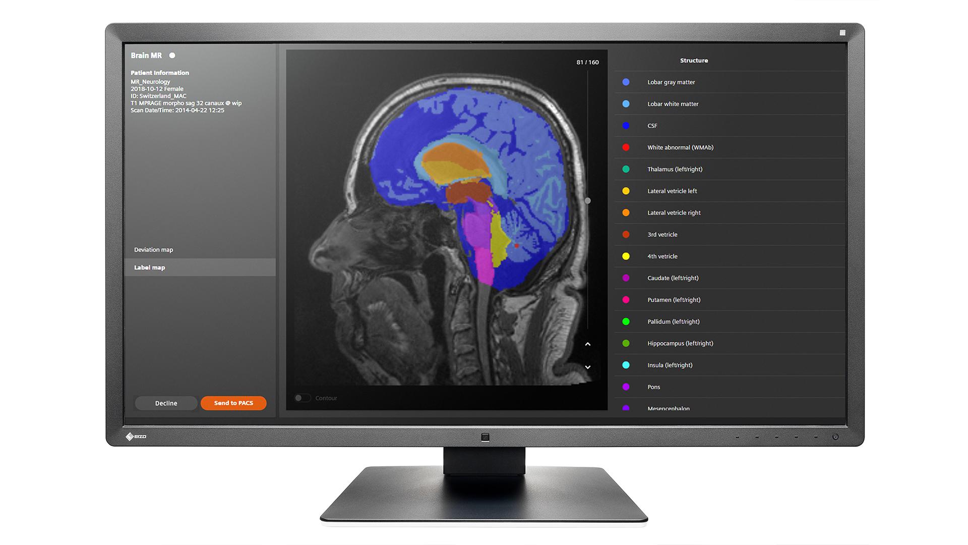 Magnetic Resonance Imaging - Siemens Healthineers Vietnam