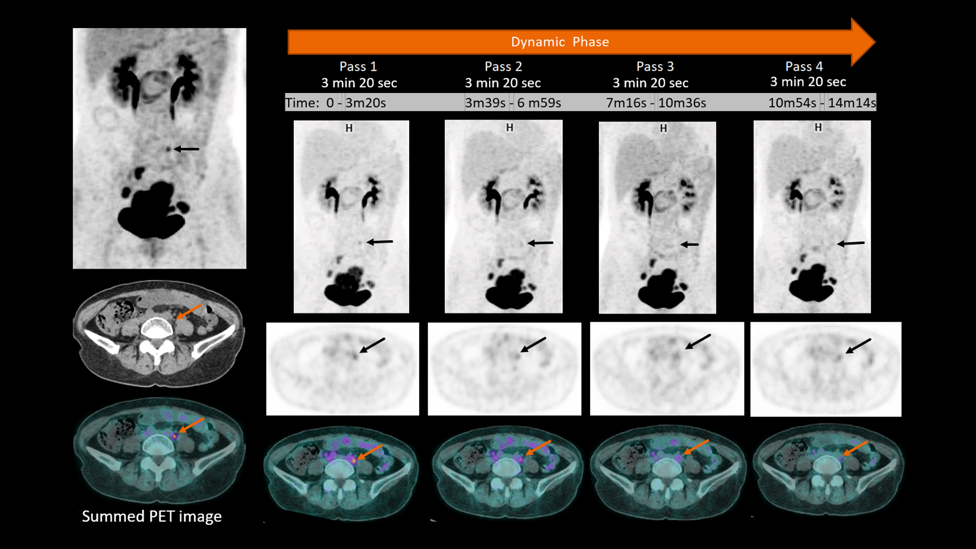 Biograph Horizon PET/CT scanner - Siemens Healthineers