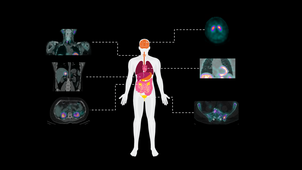 Symbia Pro.specta SPECT/CT - Siemens Healthineers Japan Symbia Pro.specta SPECT/CT - Siemens Healthineers Japan