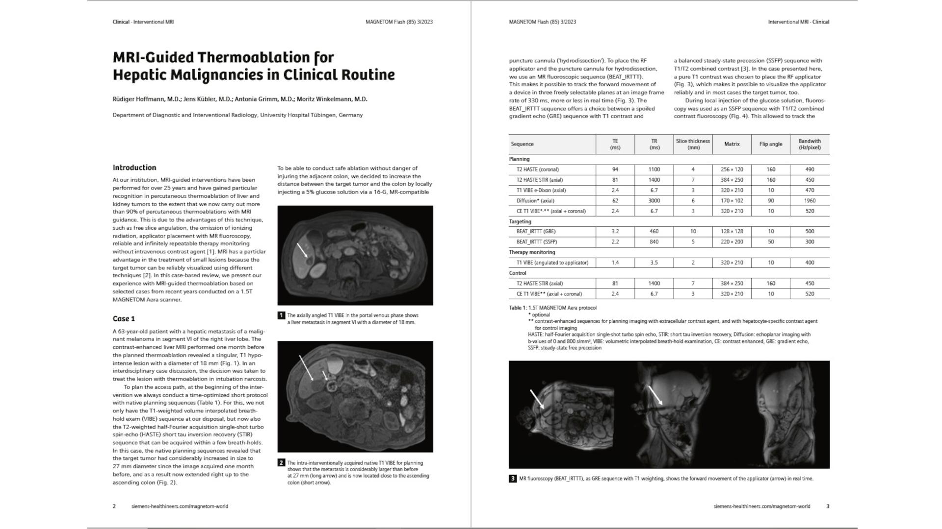 MRI Case Studies, MRI Case Study, MRI Case
