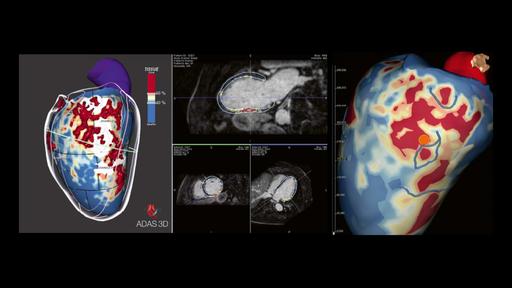 Cardiovascular MRI - Siemens Healthineers