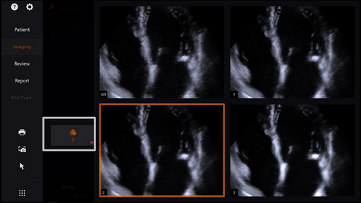 ACUSON Origin Cardiovascular Ultrasound System - Siemens Healthineers USA
