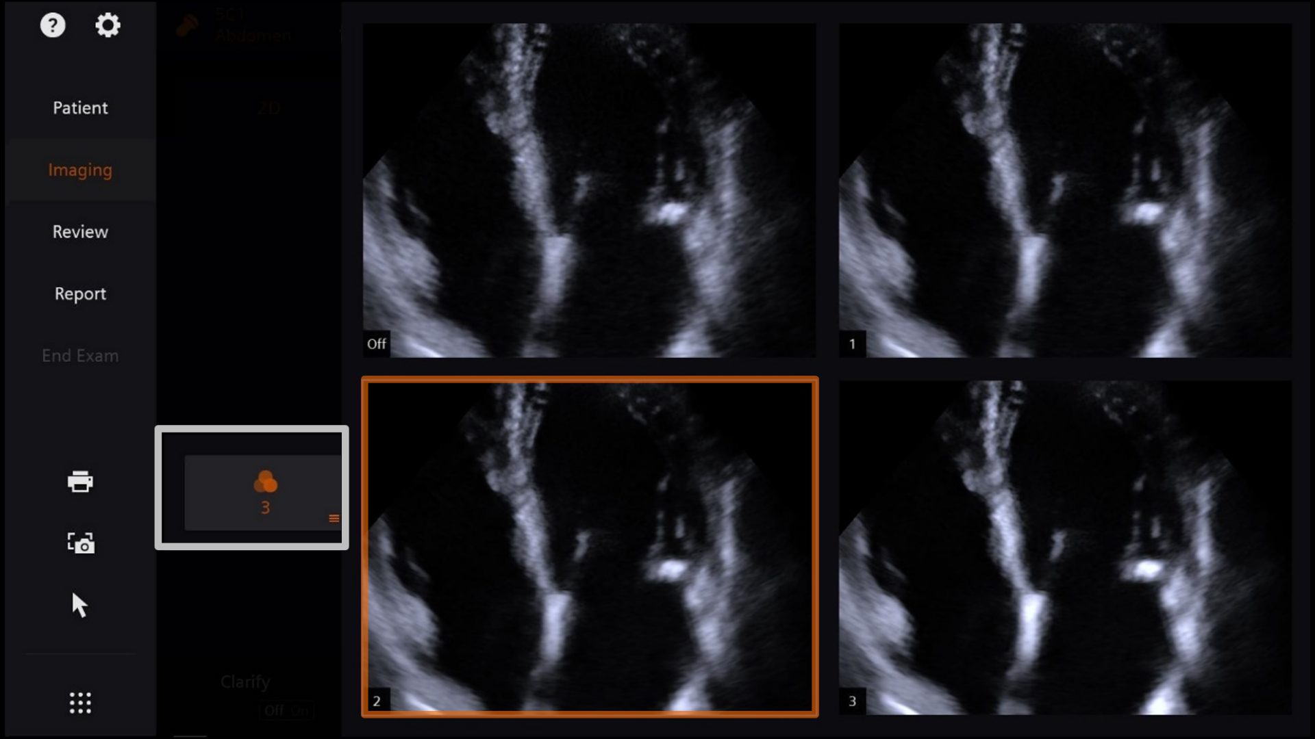 ACUSON Origin Cardiovascular Ultrasound System - Siemens Healthineers USA