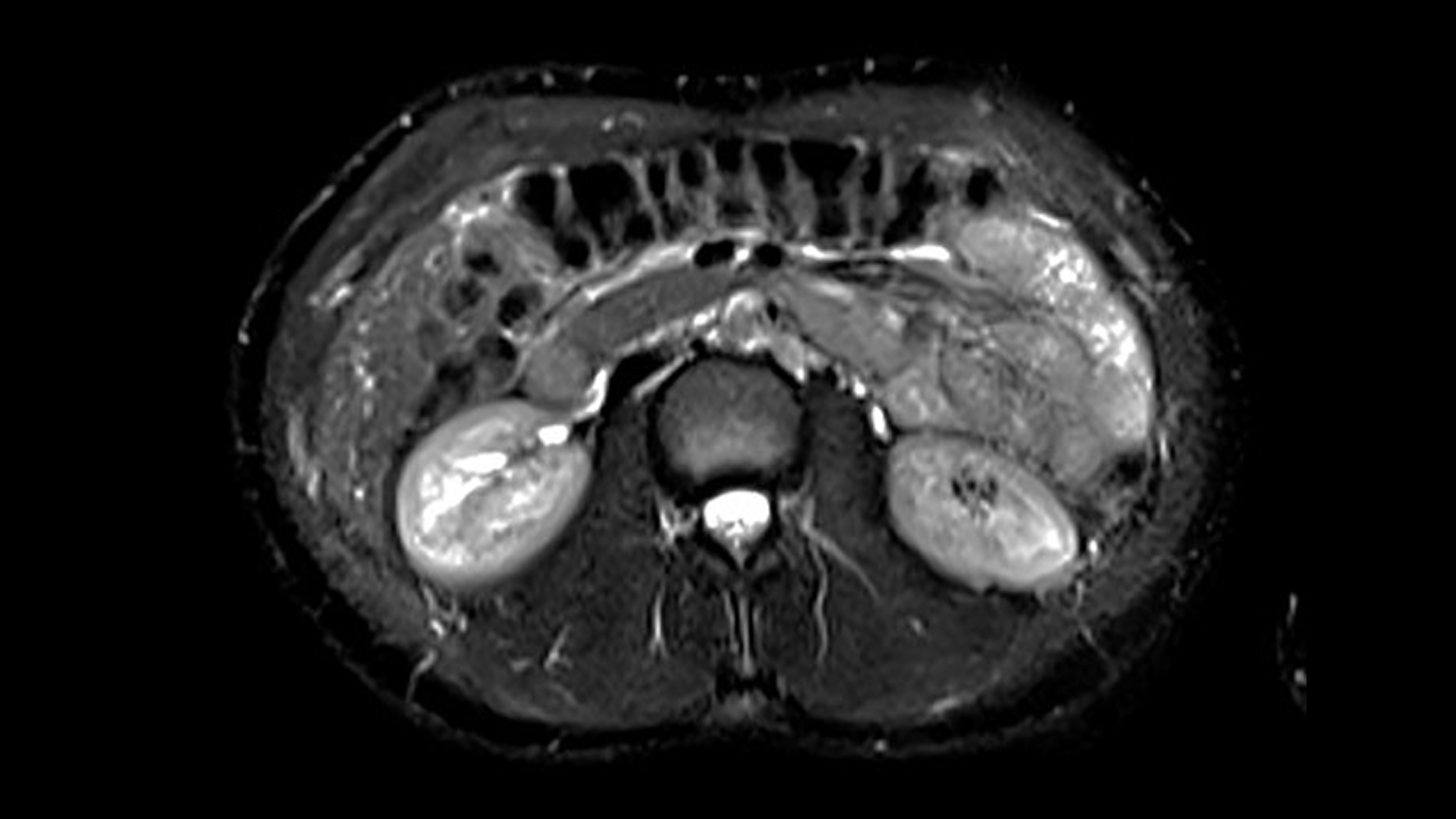 BioMatrix Technology - Siemens Healthineers