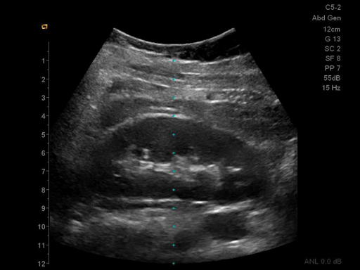 ACUSON Freestyle Wireless Ultrasound System - Siemens Healthineers