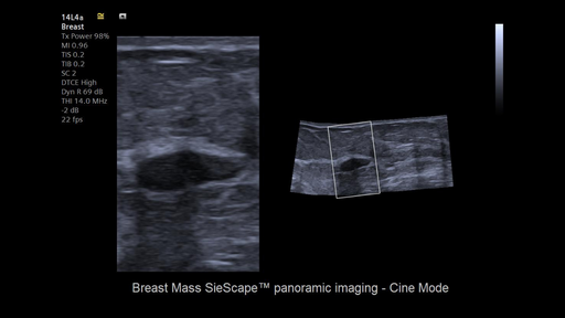 ACUSON Maple is a High-Performance Shared Service Ultrasound System ...