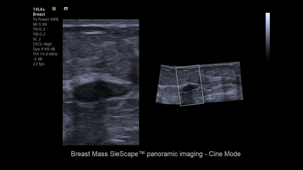 ACUSON Maple is a High-Performance Shared Service Ultrasound System ...