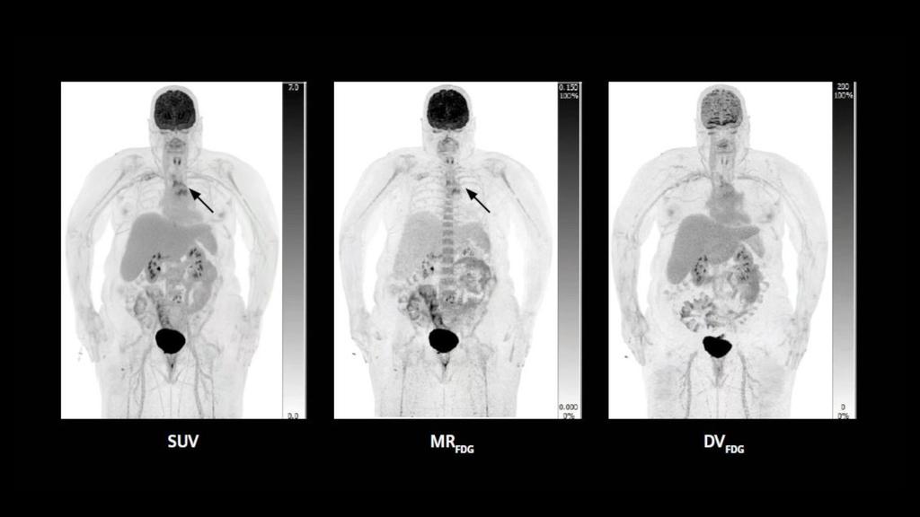 Total-body multiparametric PET/CT allows clinician researchers to see ...