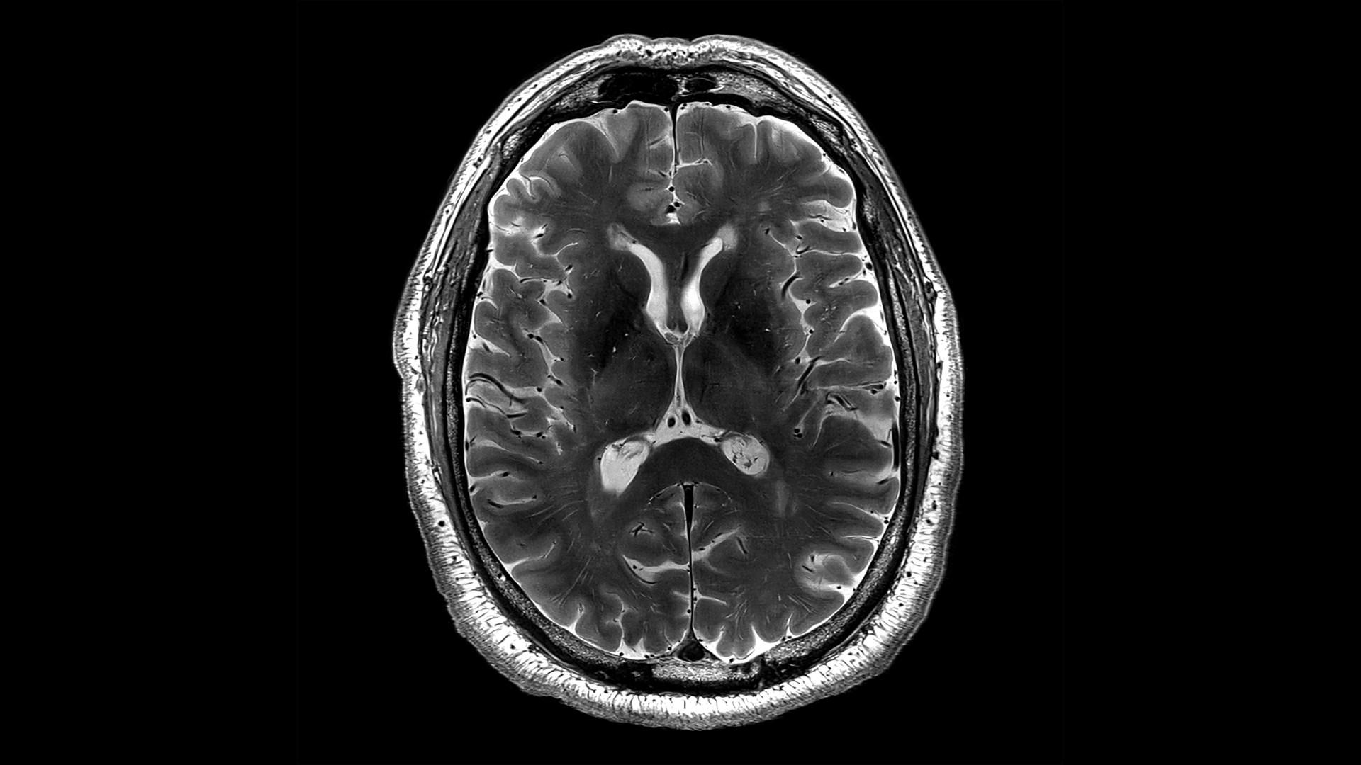 MAGNETOM Terra.X - Make the difference. - Siemens Healthineers USA