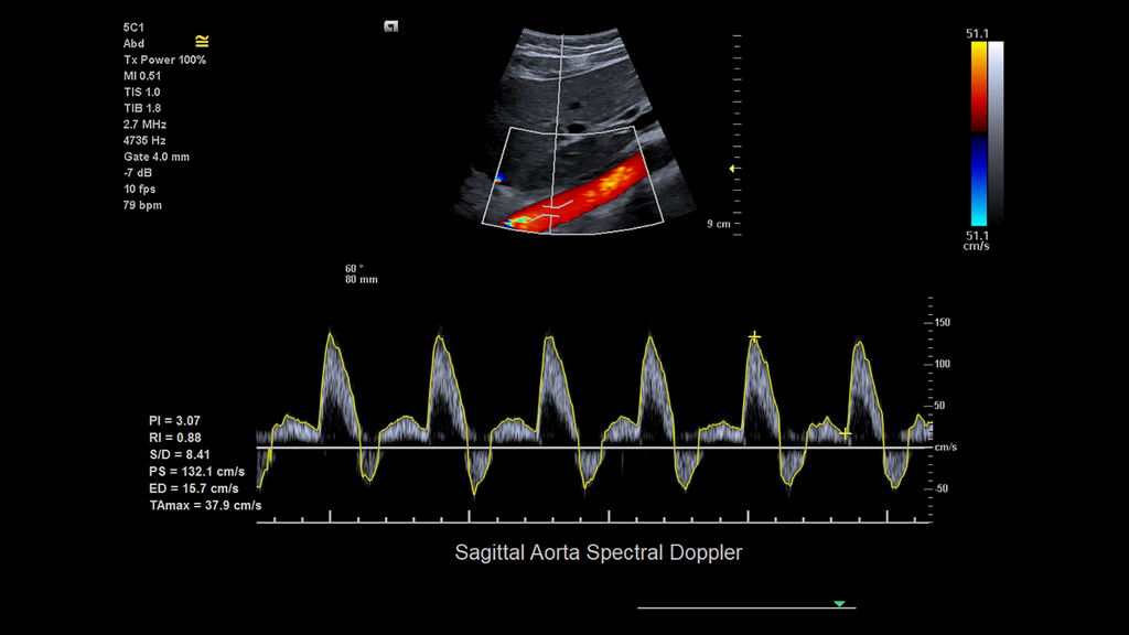 ACUSON Juniper is a High-Performance Shared Service Ultrasound System ...