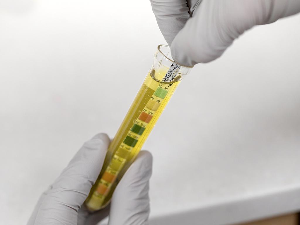 Point of Care Diagnostics - Siemens Healthineers