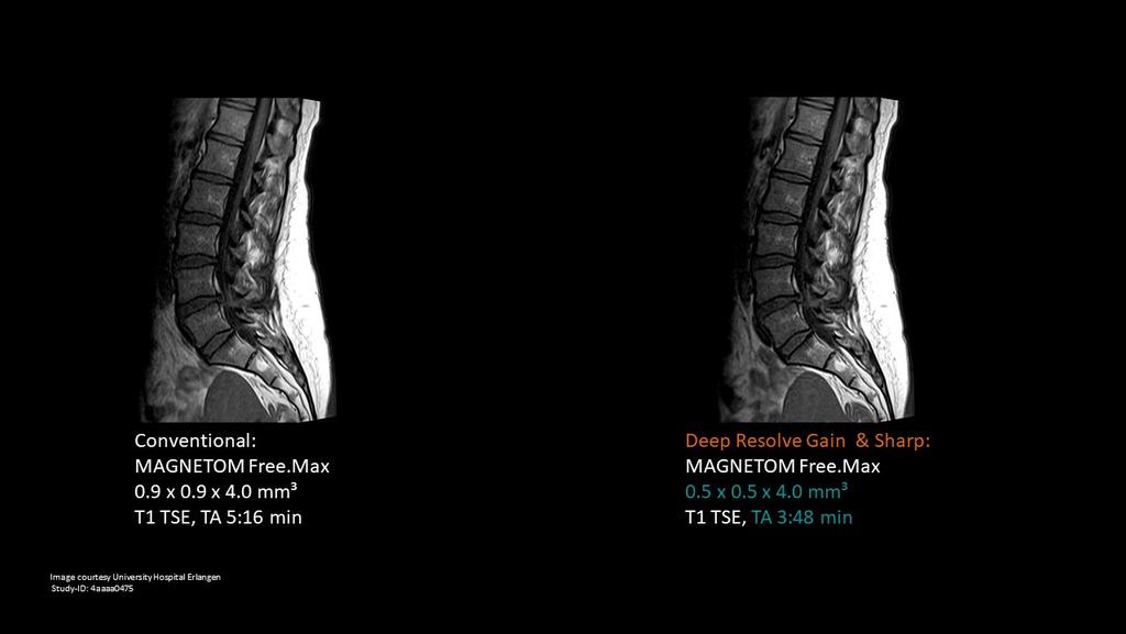 Deep Resolve - Siemens Healthineers USA