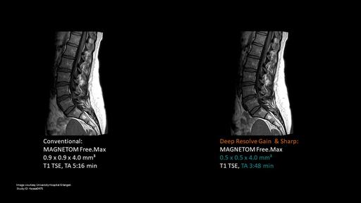 Deep Resolve - Siemens Healthineers