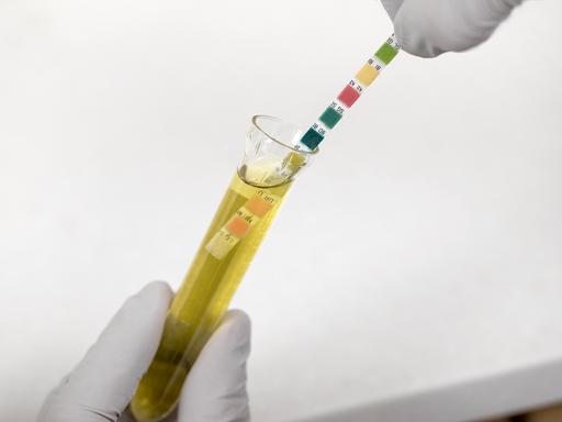 Point of Care Diagnostics