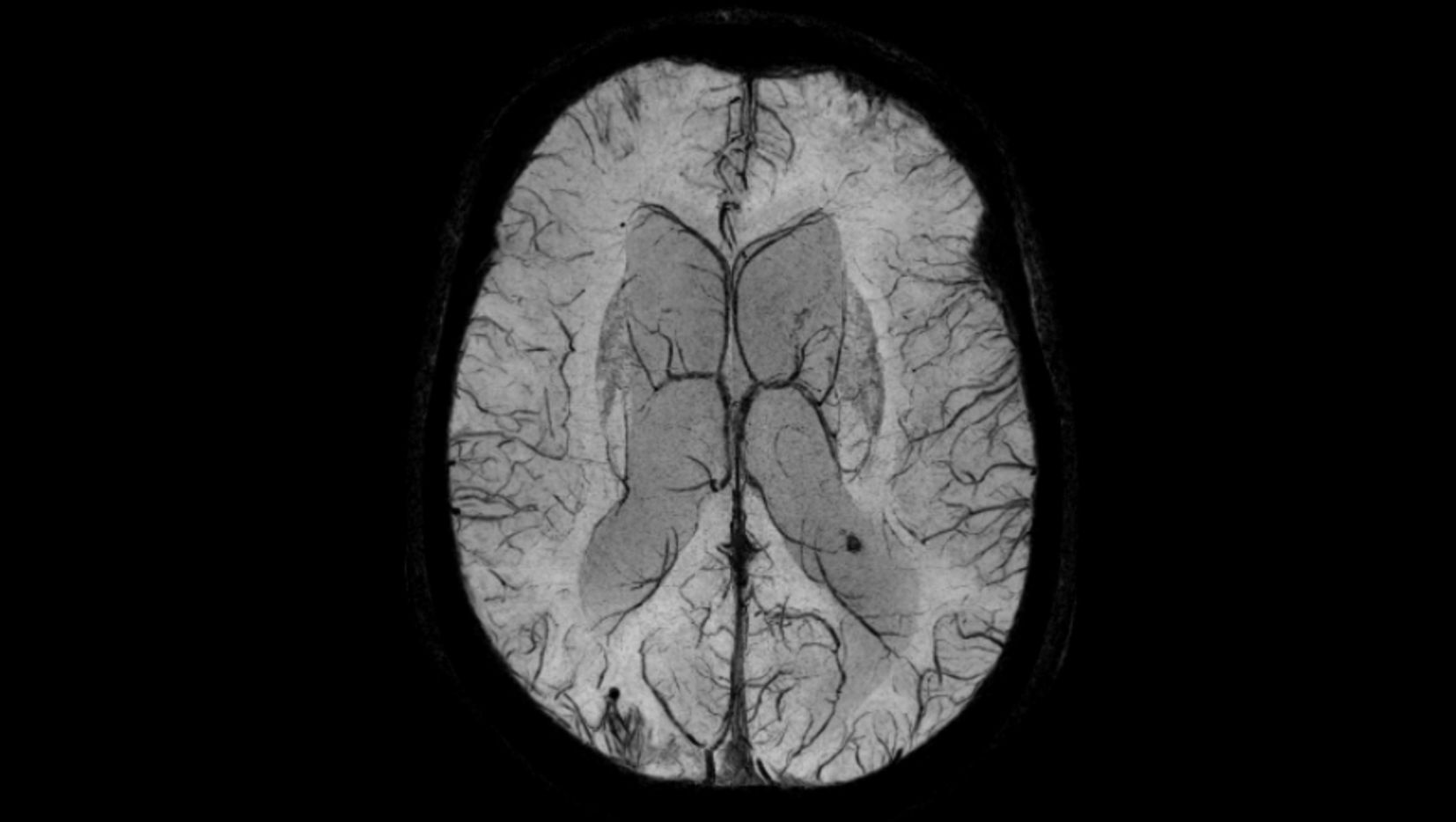 Neurology MRI - Siemens Healthineers