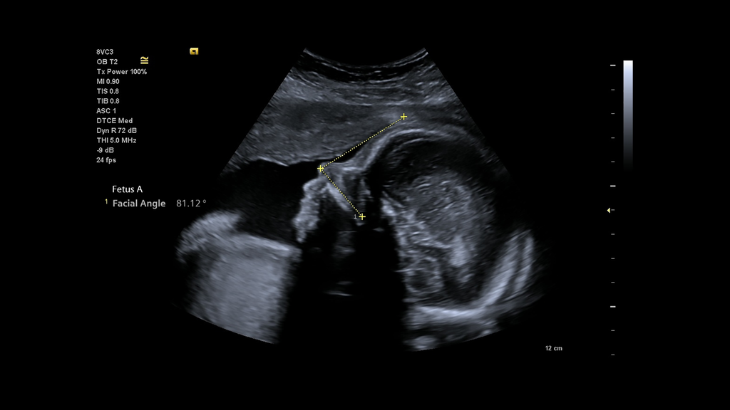 ACUSON Juniper is a High-Performance Shared Service Ultrasound System ...