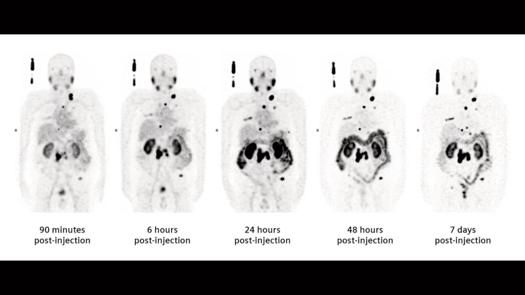 Tumor and organ dosimetry from sequential quantitative SPECT/CT ...