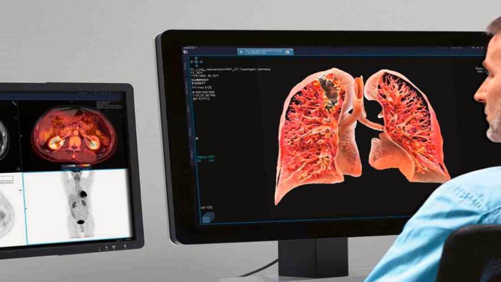 Soluciones integrales para imágenes de tórax - Siemens Healthineers ...