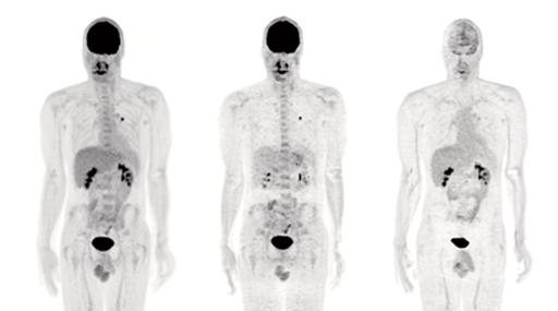 Biograph Horizon PET/CT - Siemens Healthineers USA