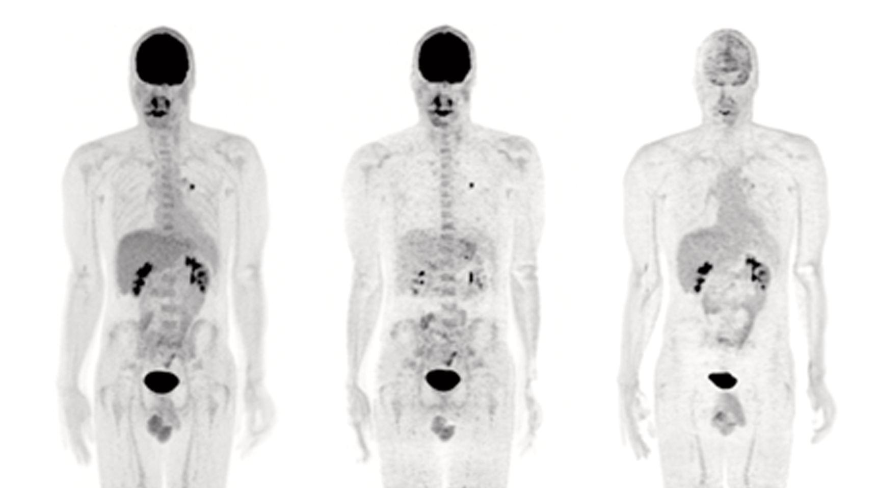 Biograph Horizon PET/CT scanner - Siemens Healthineers