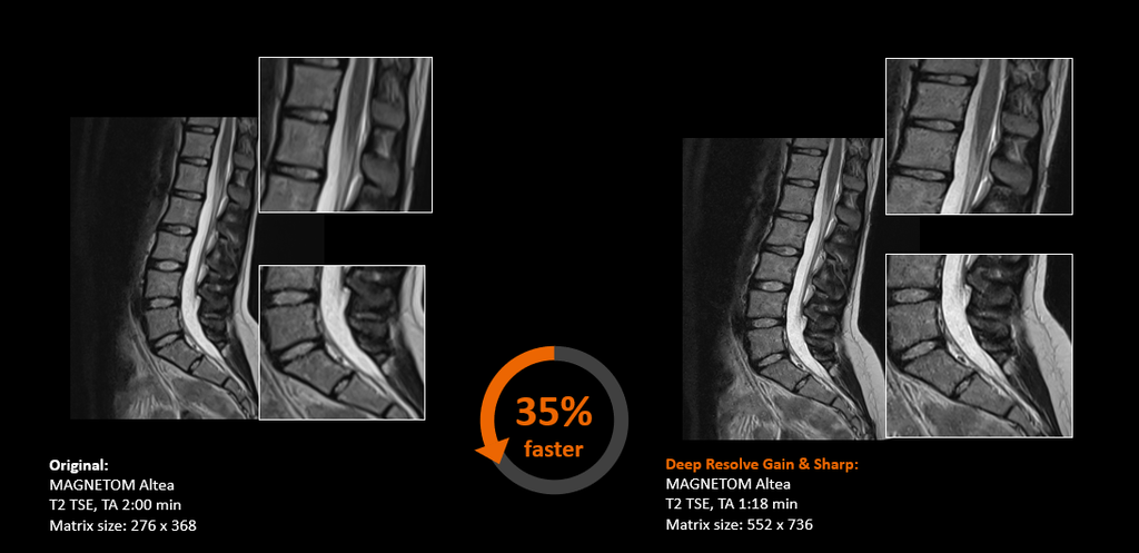 MAGNETOM Altea - Siemens Healthineers