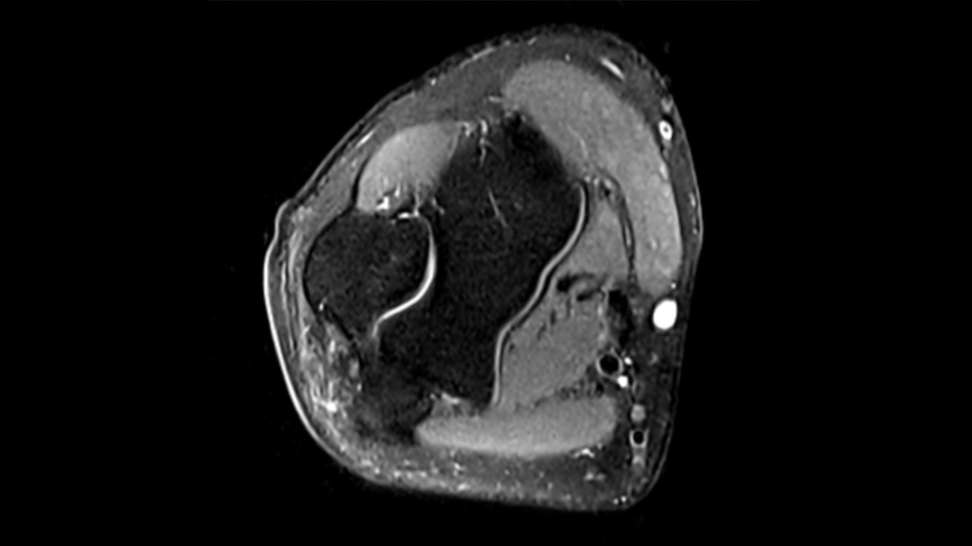 MAGNETOM Free.Star - Siemens Healthineers USA