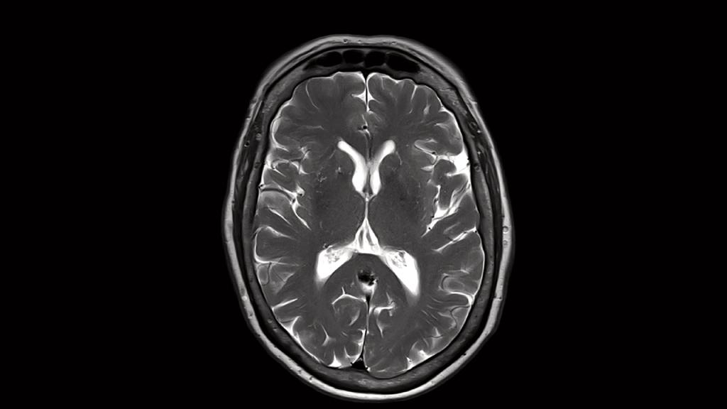 MAGNETOM Cima.X - Make the difference. - Siemens Healthineers