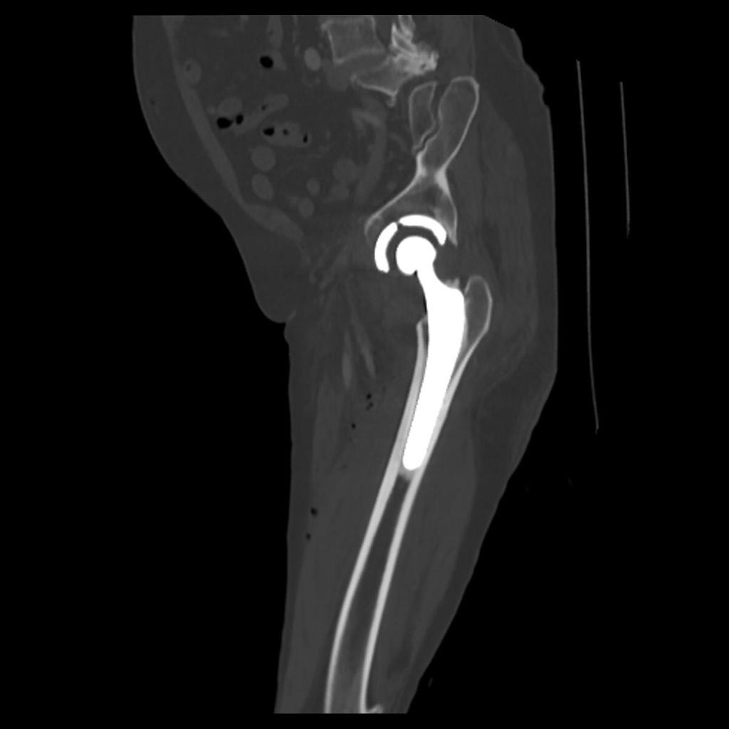 iMAR - Siemens Healthineers