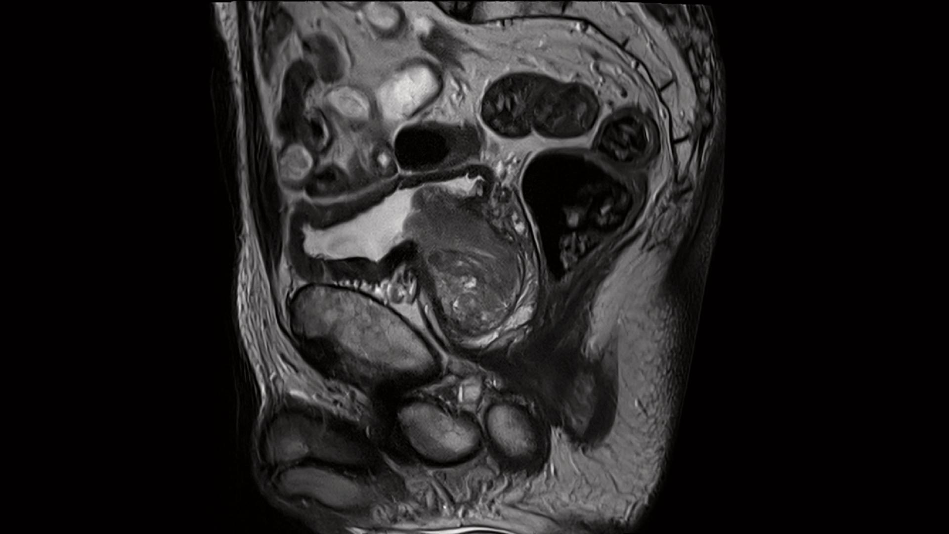 MAGNETOM Cima.X - Make the difference. - Siemens Healthineers