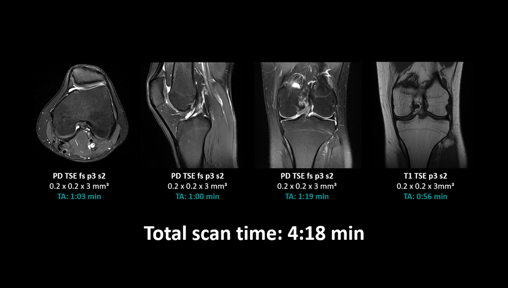 MAGNETOM Altea - Siemens Healthineers