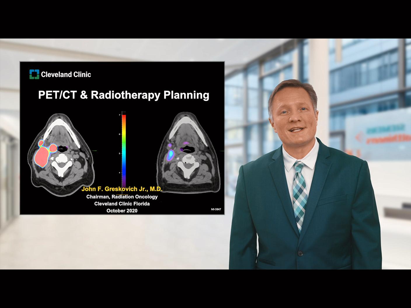 Value of PET/CT in radiation oncology - Siemens Healthineers
