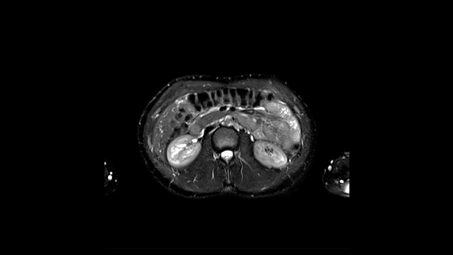 MAGNETOM Altea - Siemens Healthineers